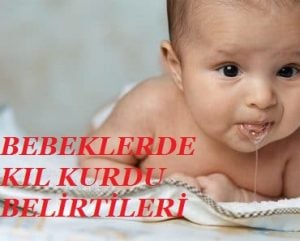 Bebeklerde Kıl Kurdu Neden Olur, Belirtileri Ve Tedavisi - Sağlık Haberleri